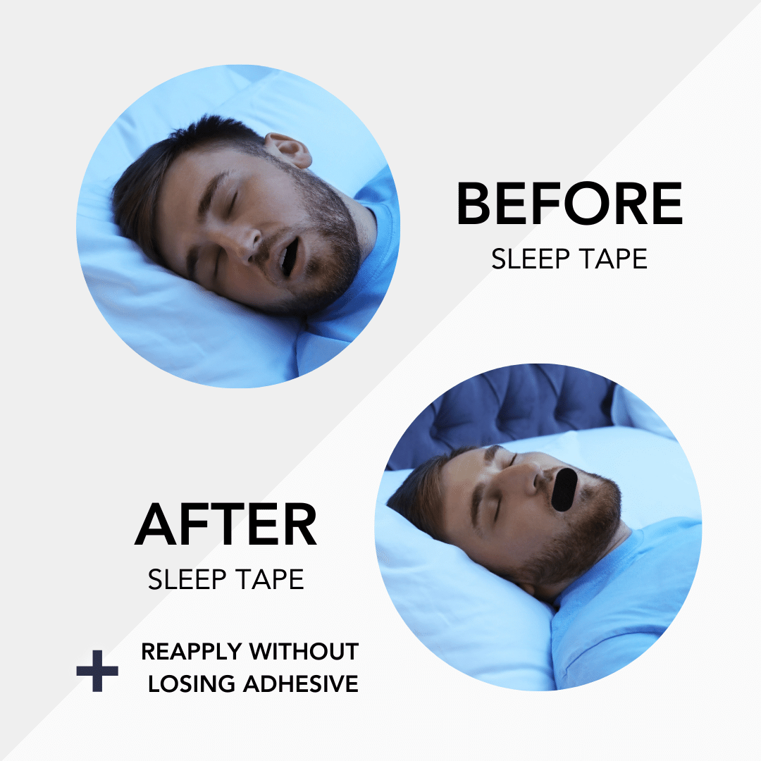 The Tape® | Premium Looksmaxxing Nasaletics® Sleep Tape | Sports-Frien ...
